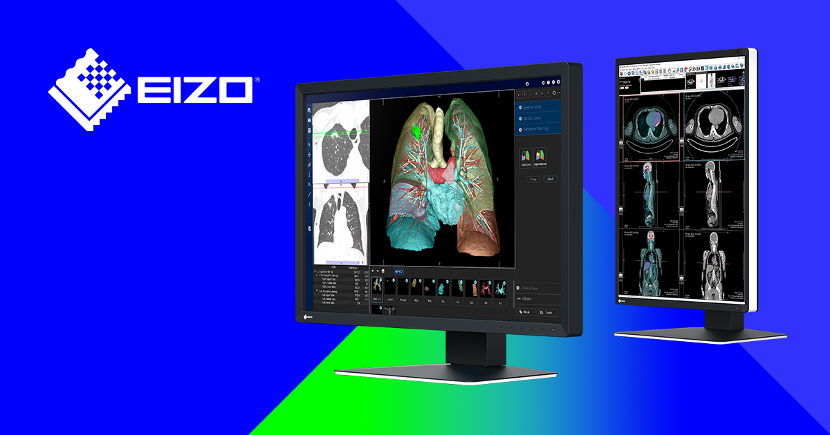 EIZO | Termékek vásárlása RadiForce