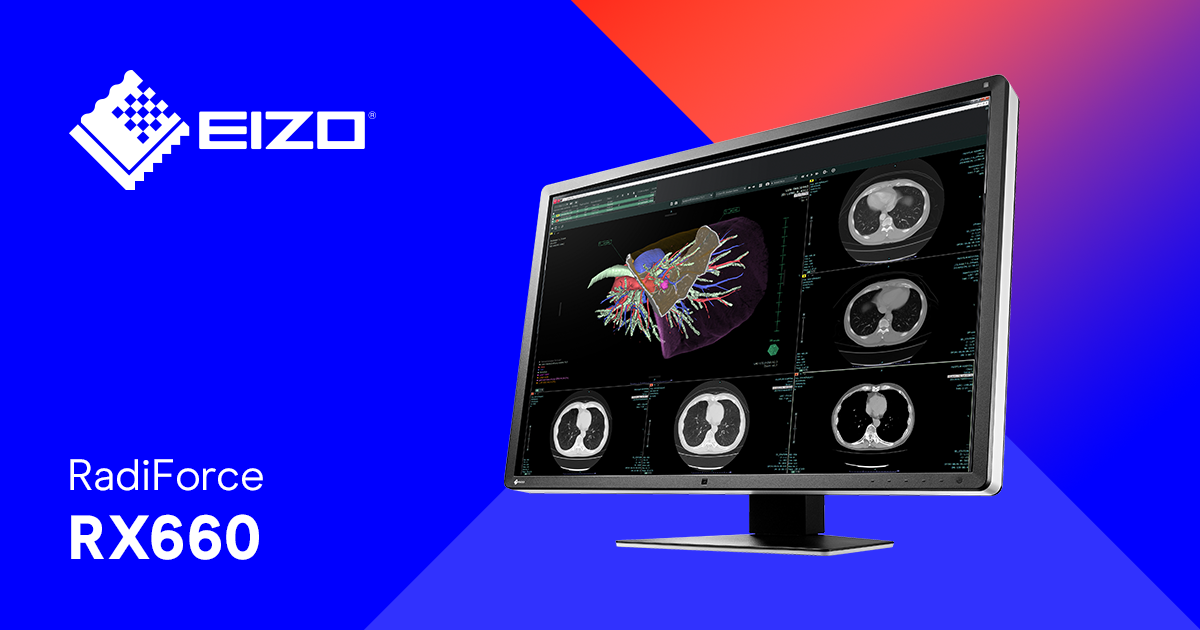 RadiForce RX660 | 6 MP diagnosztikai monitor (színes)